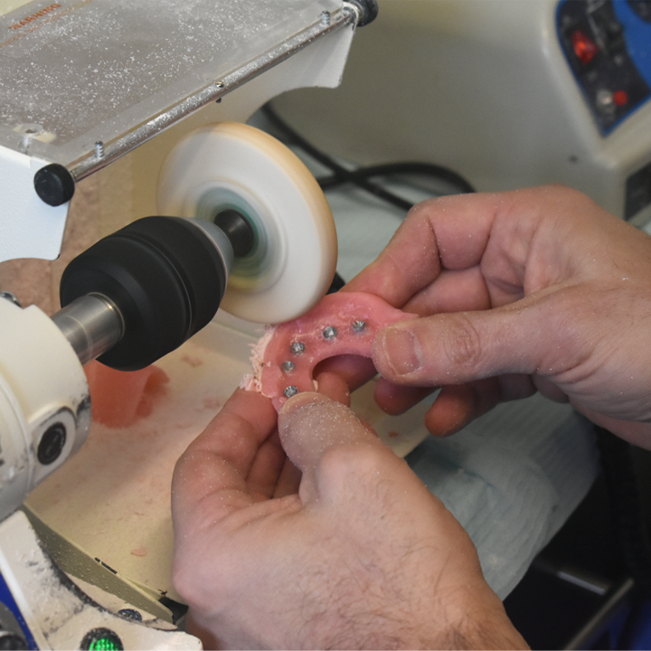 Smart Denture Conversion - Acqua-Dent
