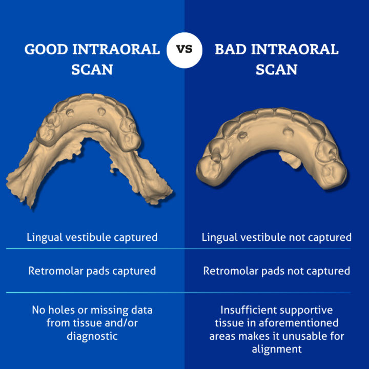 Intraoral Scanning - Acqua-Dent